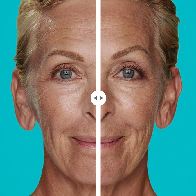 treatment-face - Cotswold Face & Body Clinic